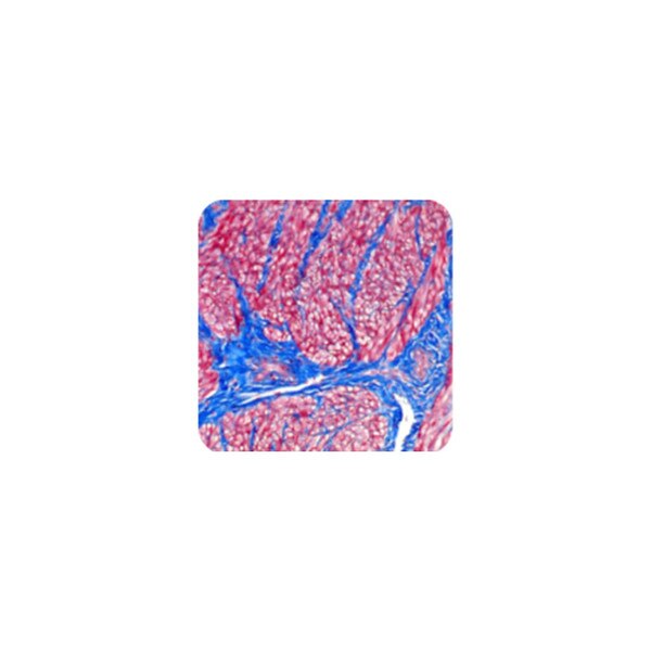 Trichrome Stain Kit (Modified Masson's) | Azer Scientific