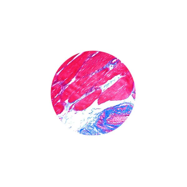 Trichrome Stain Kit (Modified Masson's) | Azer Scientific