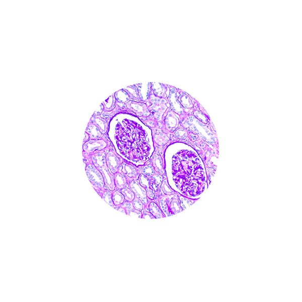 Periodic Acid Schiff (PAS) Stain Kit (Modified Lillie's) | Azer Scientific