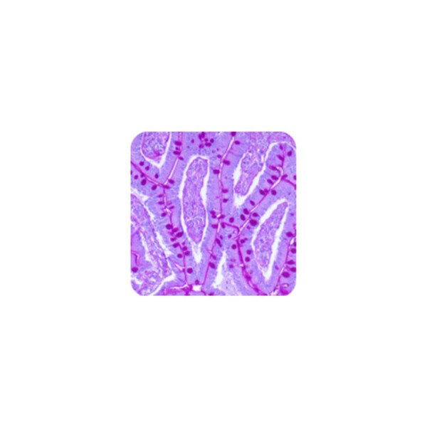 Periodic Acid Schiff (PAS) Stain Kit (Modified Lillie's) | Azer Scientific