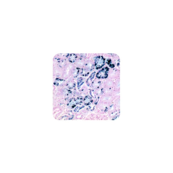 Iron Stain Kit | Azer Scientific