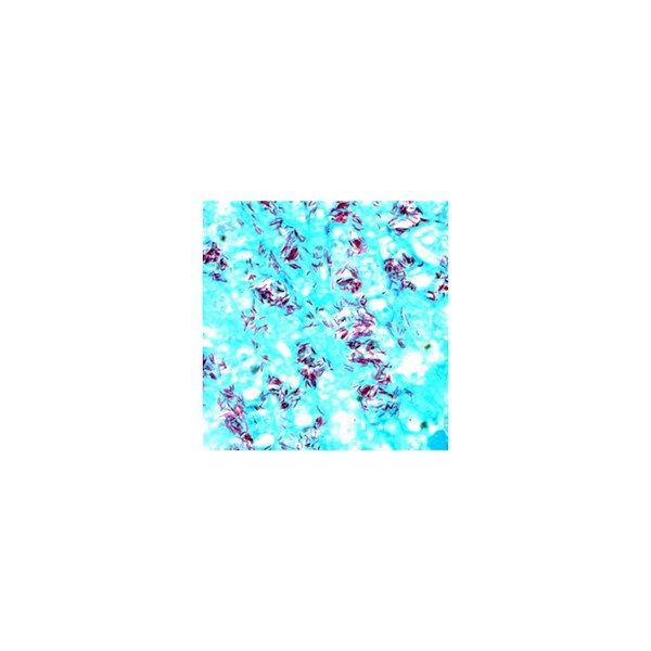 Acid Fast Bacteria (AFB) Stain Kit | Azer Scientific