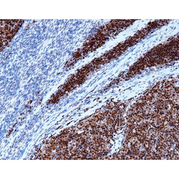 Terminal Deoxnucleotidyl Transferase (TdT) | Azer Scientific