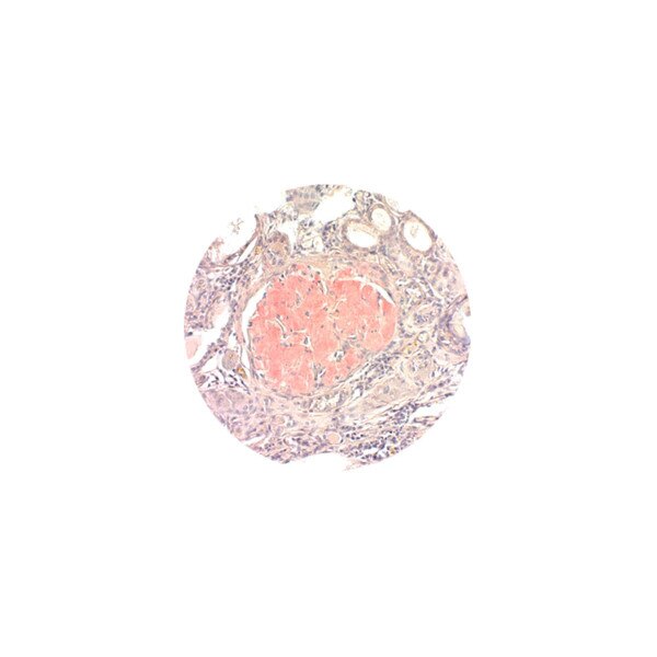 Amyloid Stain Kit (Congo Red) | Azer Scientific