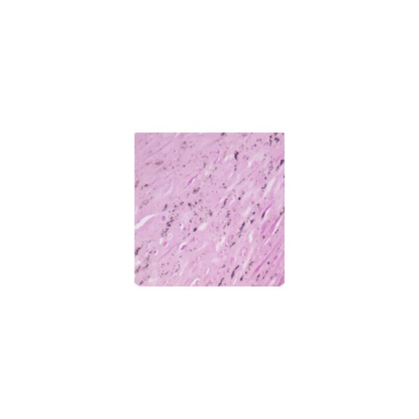 Calcium Stain Kit (Modified Von Kossa) | Azer Scientific