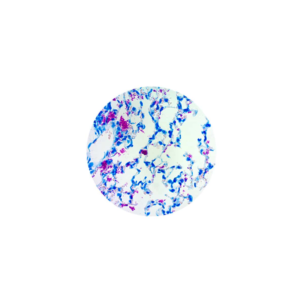 Fite's Stain Kit (Leprosy and Nocardia Procedures) | Azer Scientific