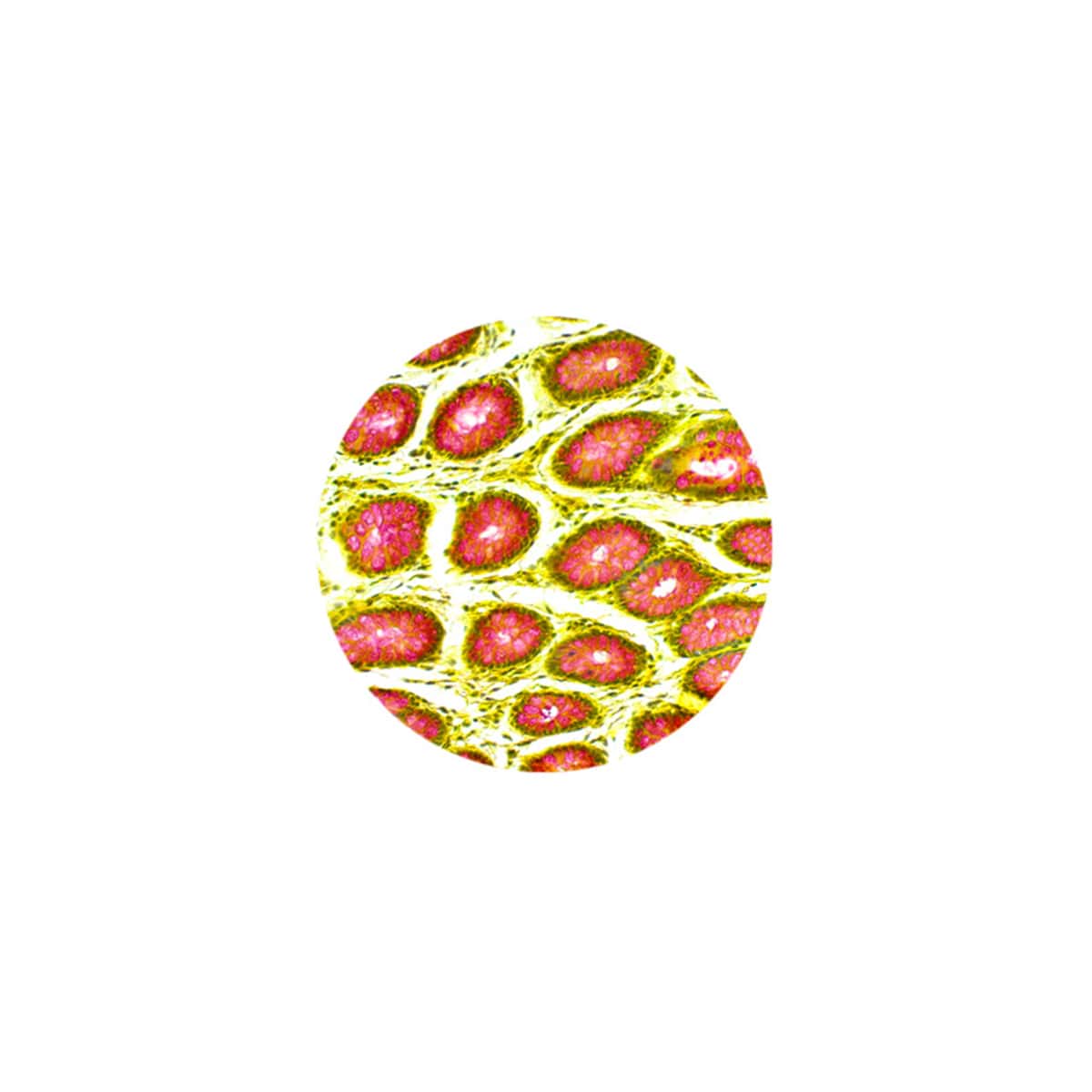 Mucicarmine Stain Kit (Modified Southgate's) | Azer Scientific