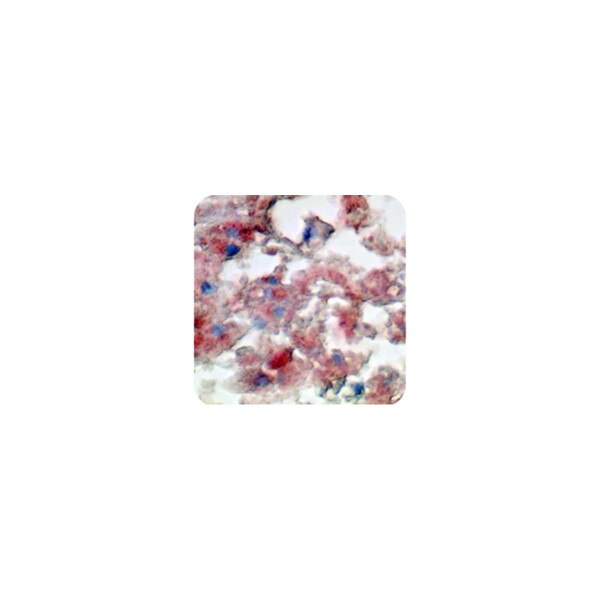 Oil Red O Stain Kit (For Fat) | Azer Scientific