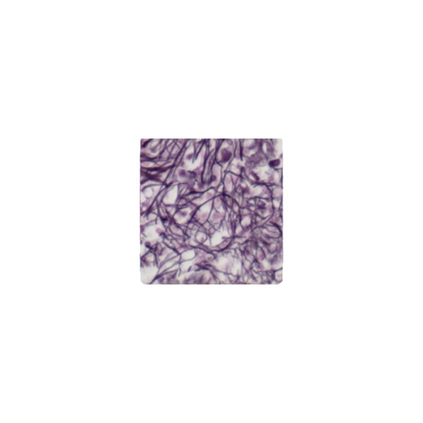 Reticulum Stain Kit (Modified Gomori's) | Azer Scientific