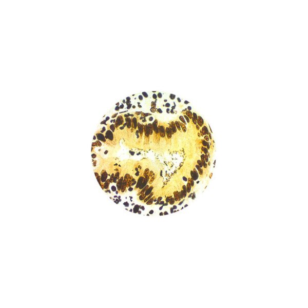 Warthin-Starry Stain Kit | Azer Scientific