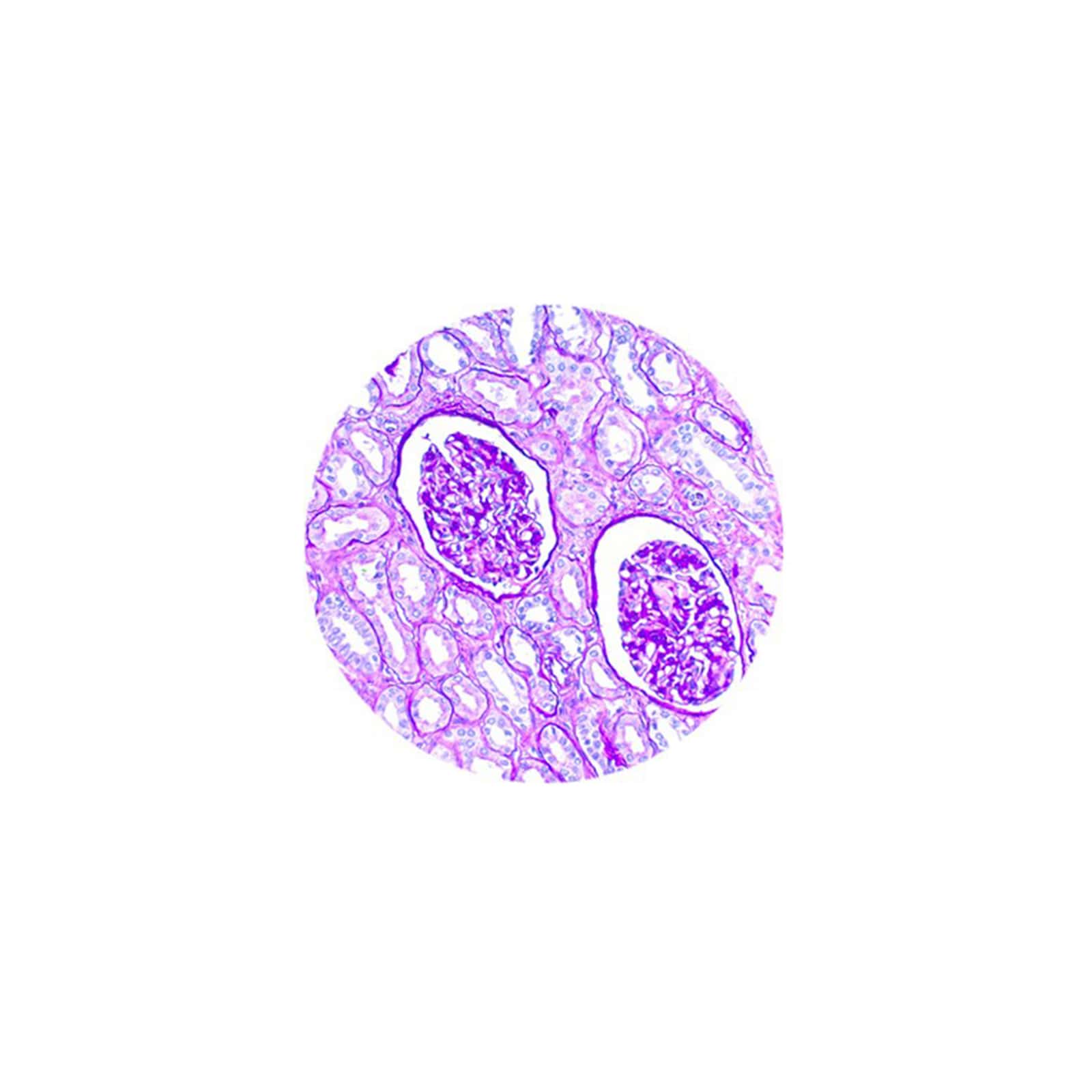 Periodic Acid Schiff (PAS) Diastase Stain Kit | Azer Scientific