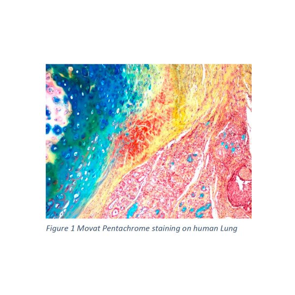 Movat Pentachrome Stain Kit | Azer Scientific