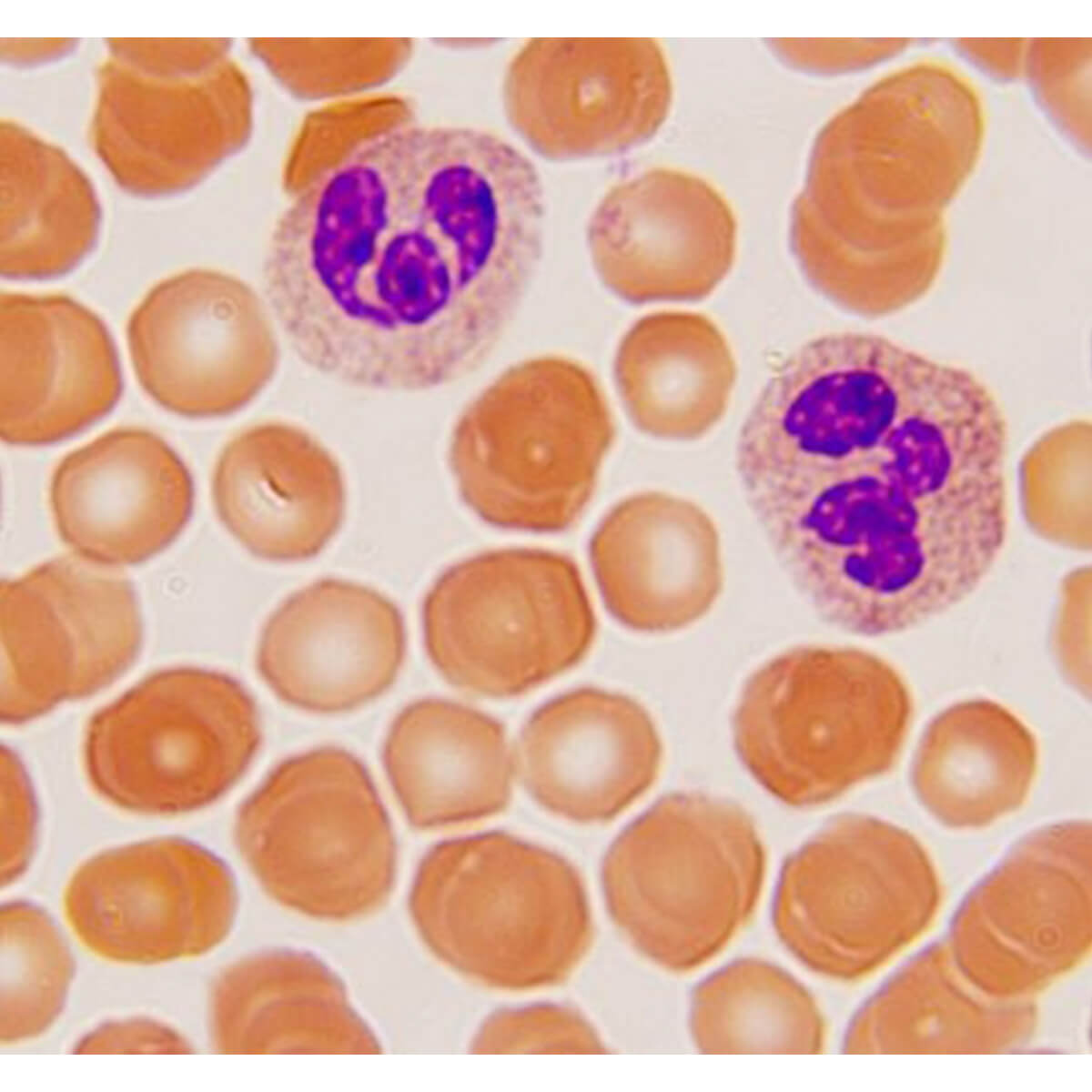 Wright Stain | Azer Scientific