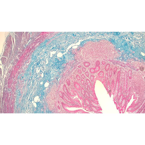Control Slide, Histology, Masson's Trichrome | Azer Scientific
