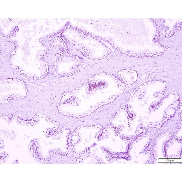 IHC Tissue Control Slide, PIN-4 | Azer Scientific