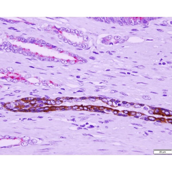IHC Tissue Control Slide, PIN-4 | Azer Scientific