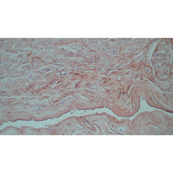 Control Slide, Histology IHC stain, Amyloid P | Azer Scientific