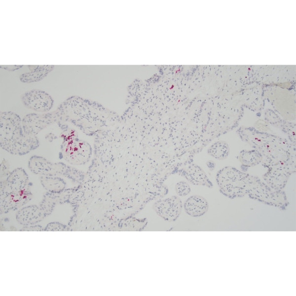 Control Slide, Histology IHC stain, Cytomegalovirus | Azer Scientific