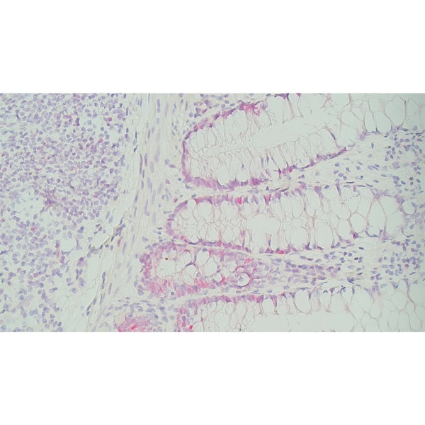 Control Slide, Histology IHC stain, P53 | Azer Scientific