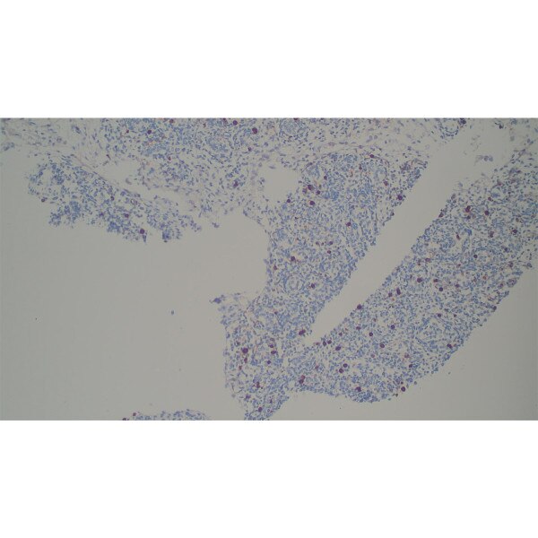 Control Slide, Histology IHC stain, PARVOVIRUS B19 | Azer Scientific