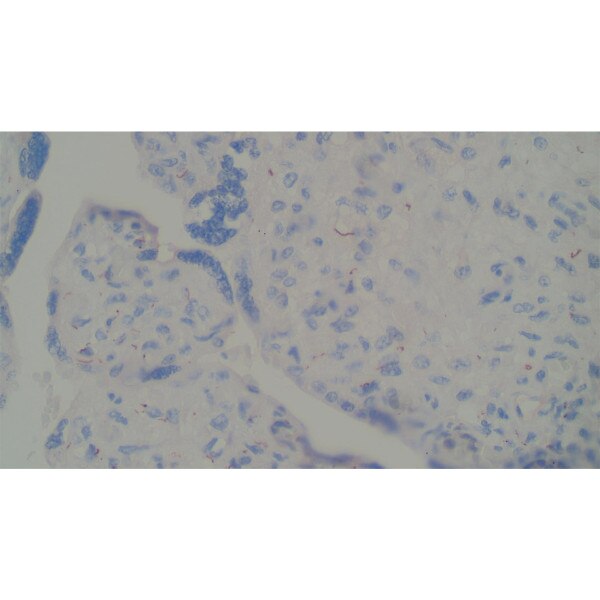 Control Slide, Histology special stain, spirochete | Azer Scientific